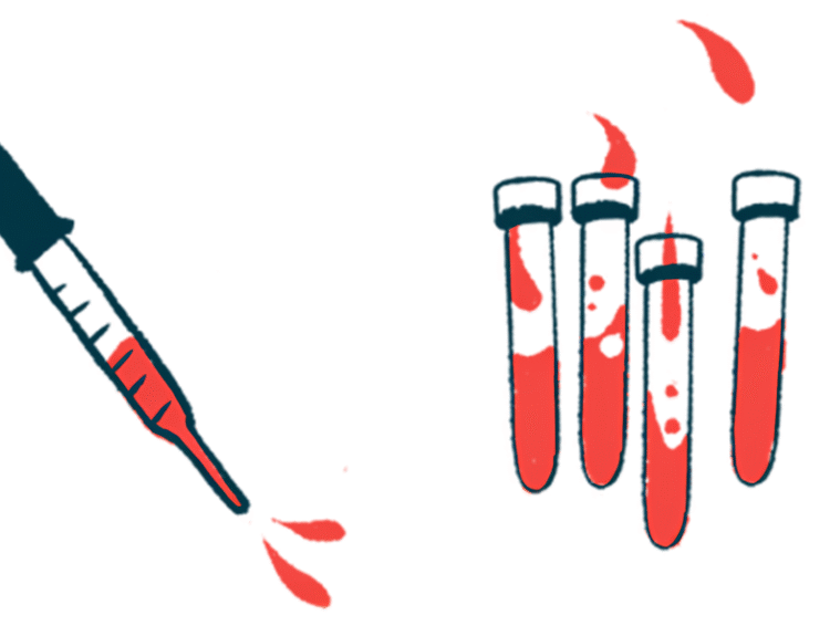New Blood Test to Assess MS Disease Activity Available Nationwide ...