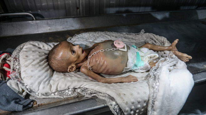 Más de 54.000 niños en Gaza sufren malnutrición aguda por el bloqueo ...